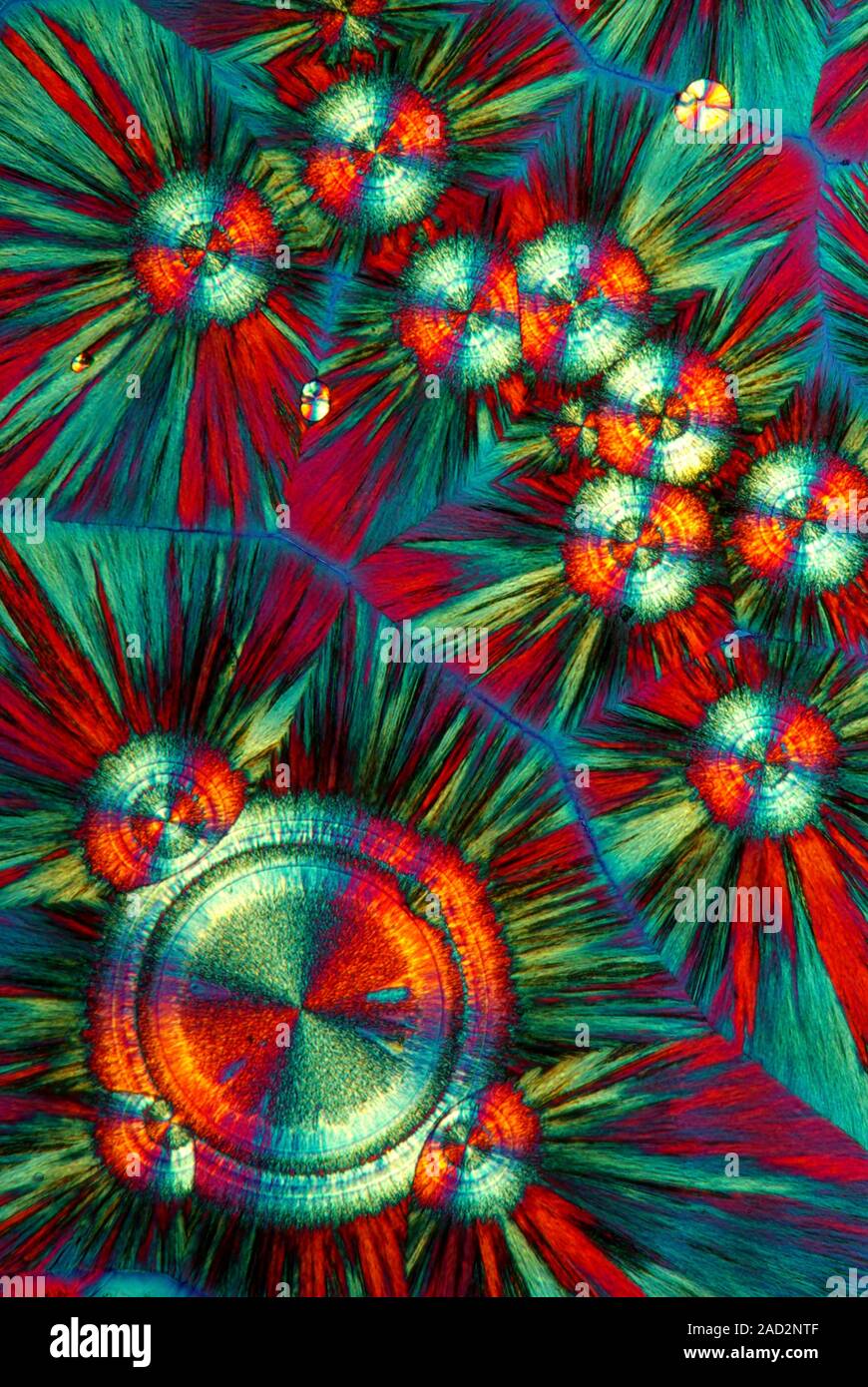 EDTA crystals. Polarised light micrograph of a section through ...