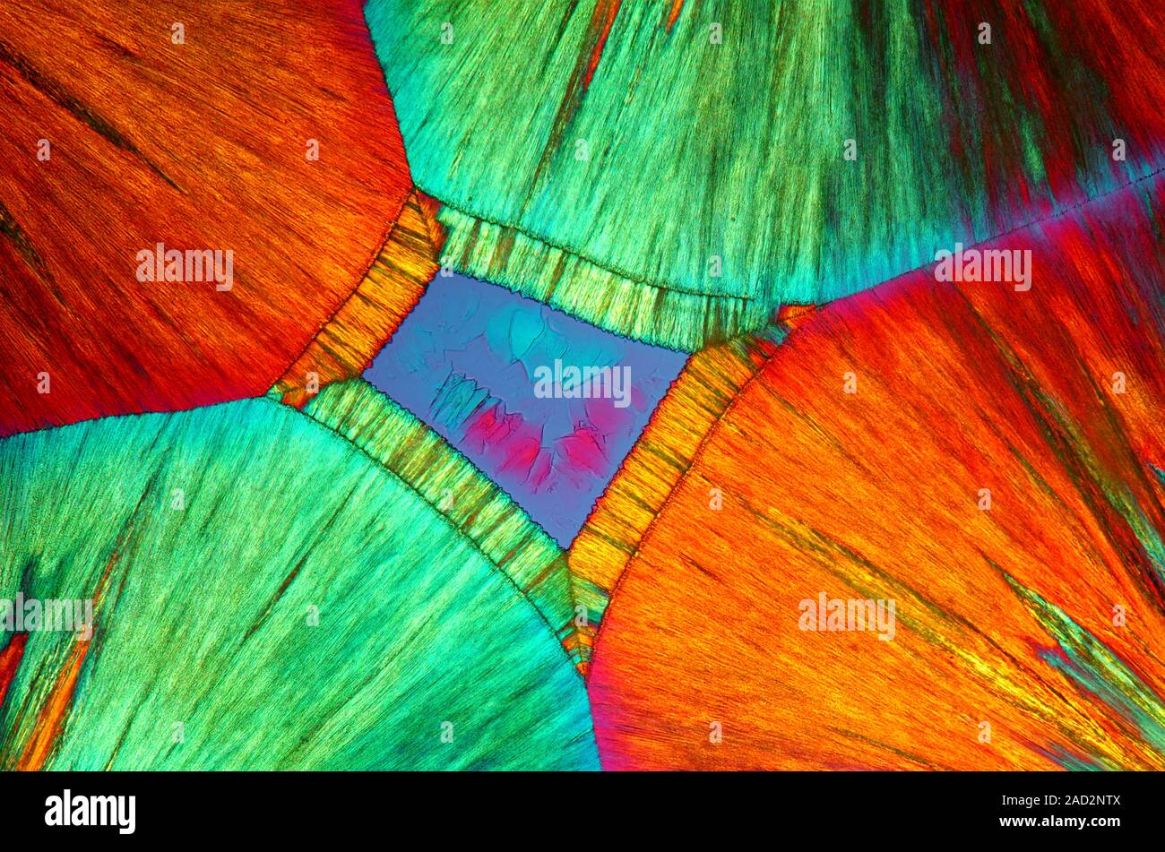 EDTA crystals. Polarised light micrograph of a section through ...
