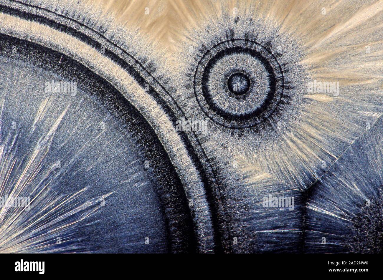 EDTA crystals. Polarised light micrograph of a section through ...