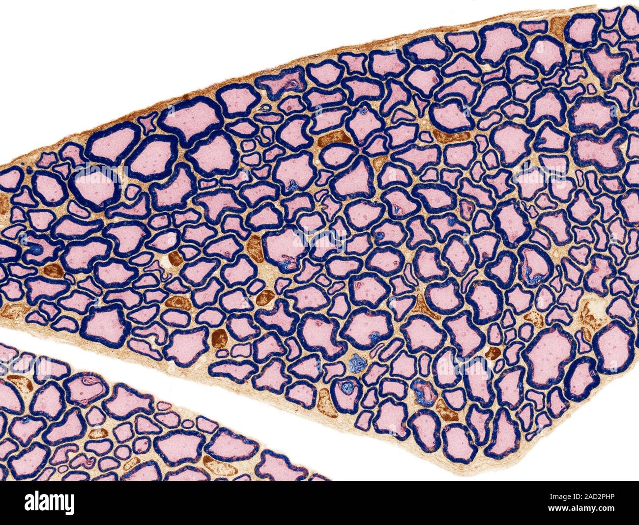 Sciatic Nerve Low Power Coloured Transmission Electron Micrograph Tem Of A Section Through