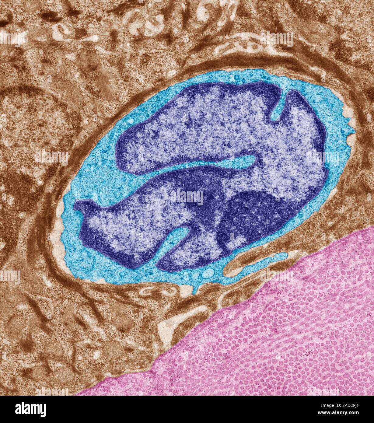 Langerhans cell. Coloured transmission electron micrograph (TEM) of a ...