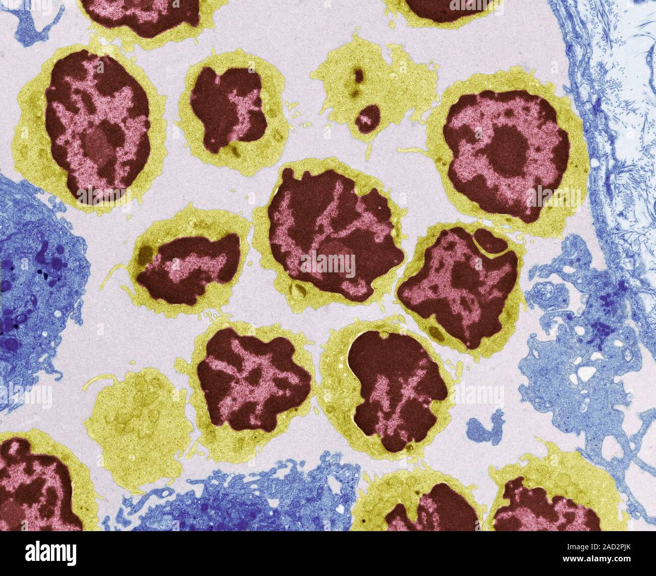 Lymph node. Coloured transmission electron micrograph (TEM) of a ...