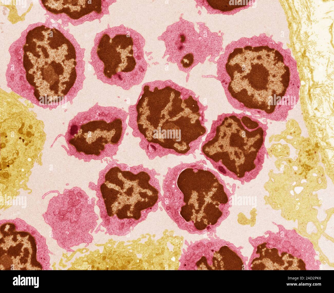 Lymph node. Coloured transmission electron micrograph (TEM) of a ...