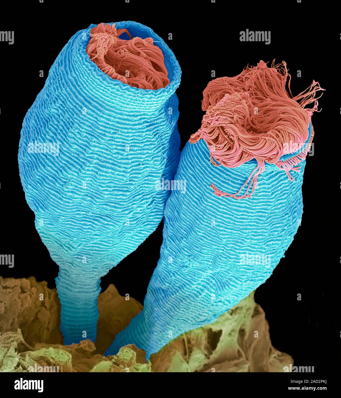 Vorticella. Coloured scanning electron micrograph (SEM). This ciliate ...