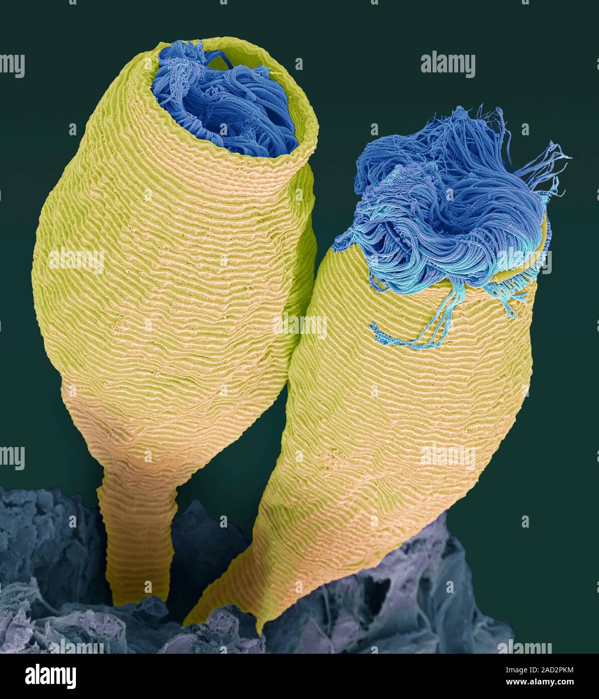 Vorticella. Coloured scanning electron micrograph (SEM). This ciliate ...