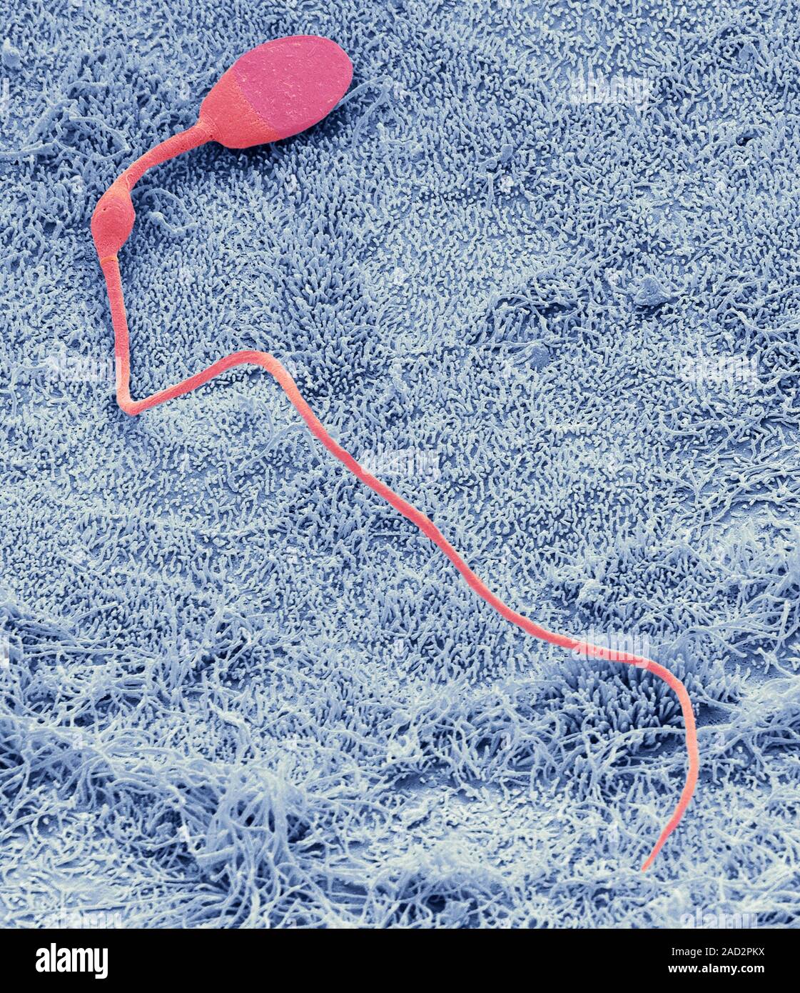 Monkey sperm. Coloured scanning electron micrograph (SEM) of immature ...