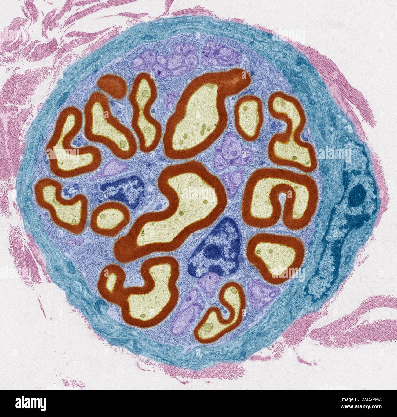 Peripheral nerve. Coloured transmission electron micrograph (TEM) of a ...