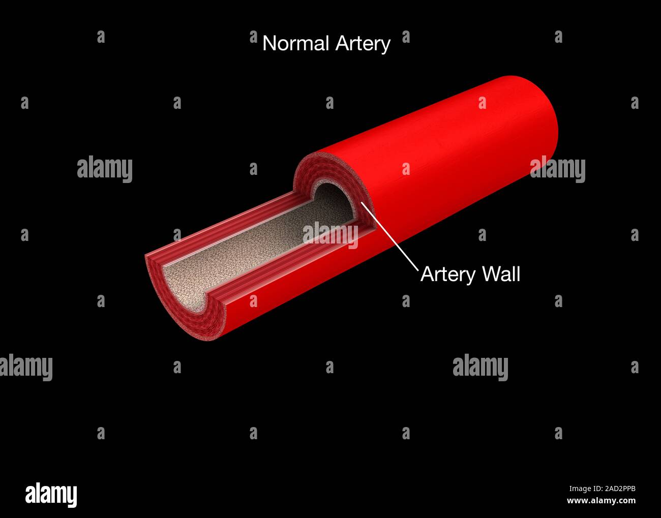 Normal artery anatomy. Cutaway computer illustration showing the ...