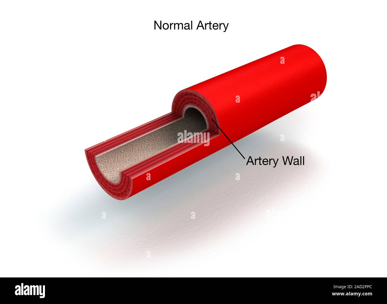 Normal artery anatomy. Cutaway computer illustration showing the ...