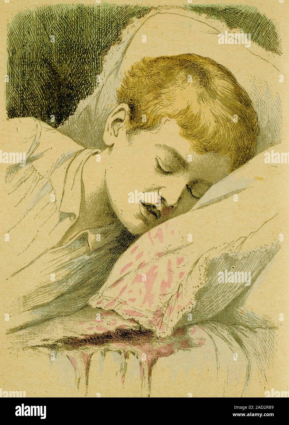 Boy with Haemophilia, an inherited blood disorder in which the clotting ...