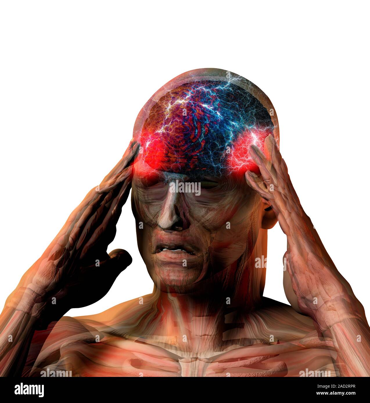 Illustration of a man with a splitting headache showing skeleton Stock Photo - Alamy