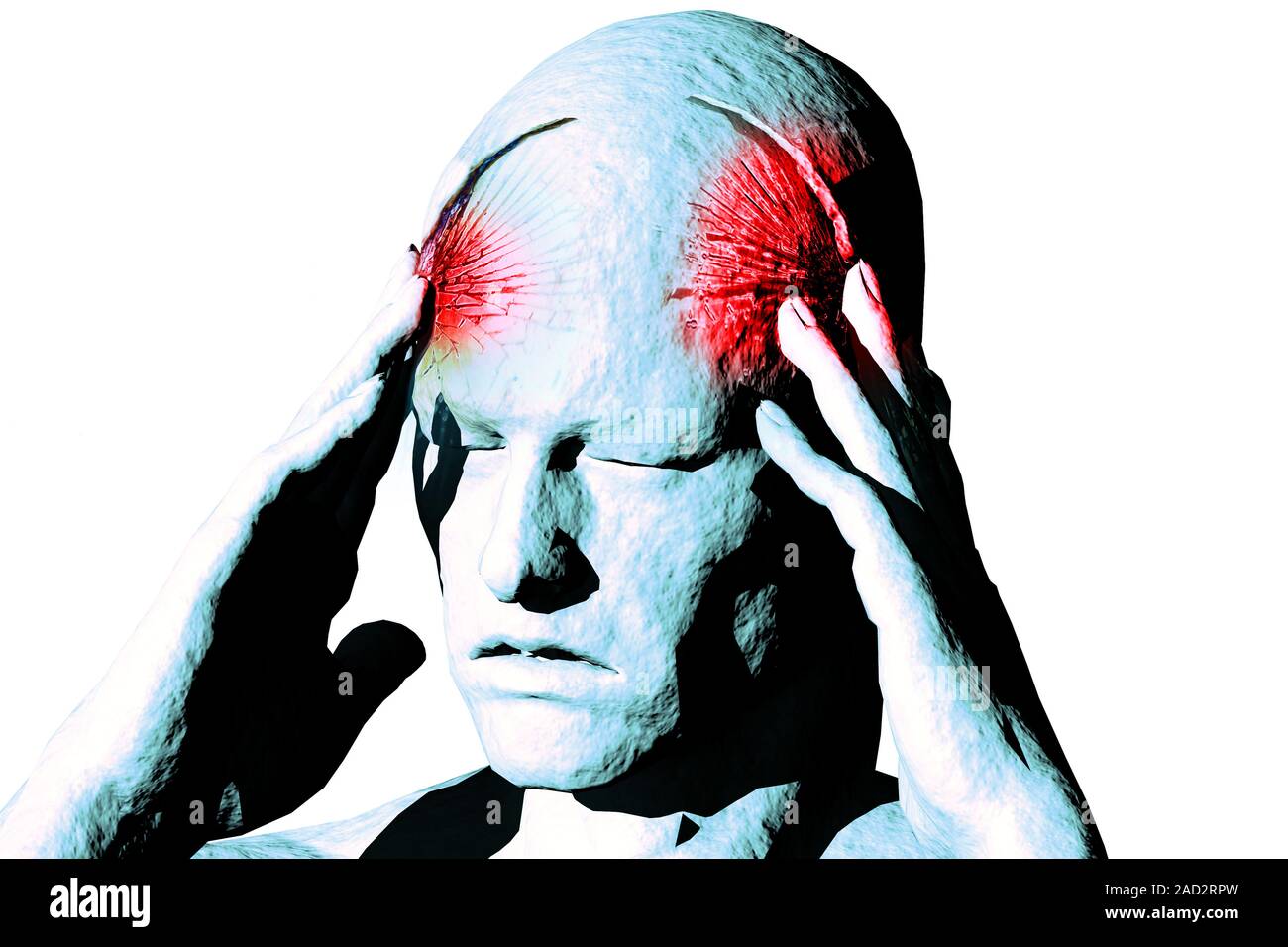 Illustration of a stone man with a splitting headache Stock Photo - Alamy
