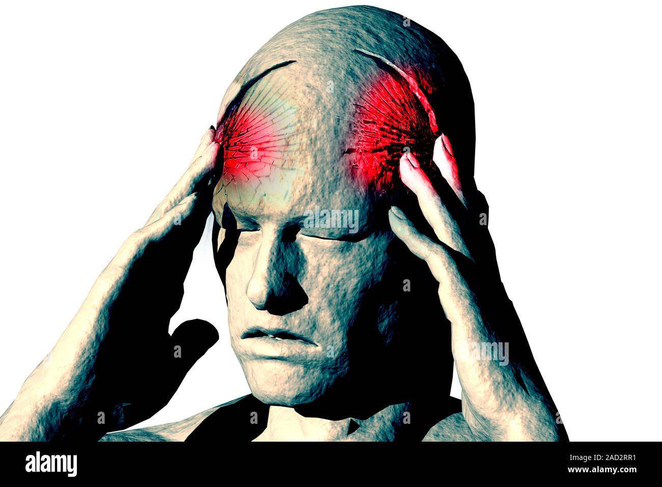 Illustration of a stone man with a splitting headache Stock Photo - Alamy