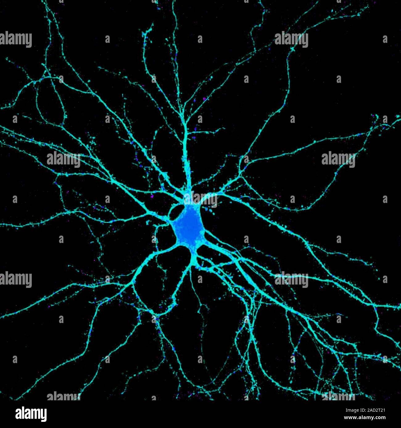 Neuron, fluorescence light micrograph. Neurons are responsible for ...