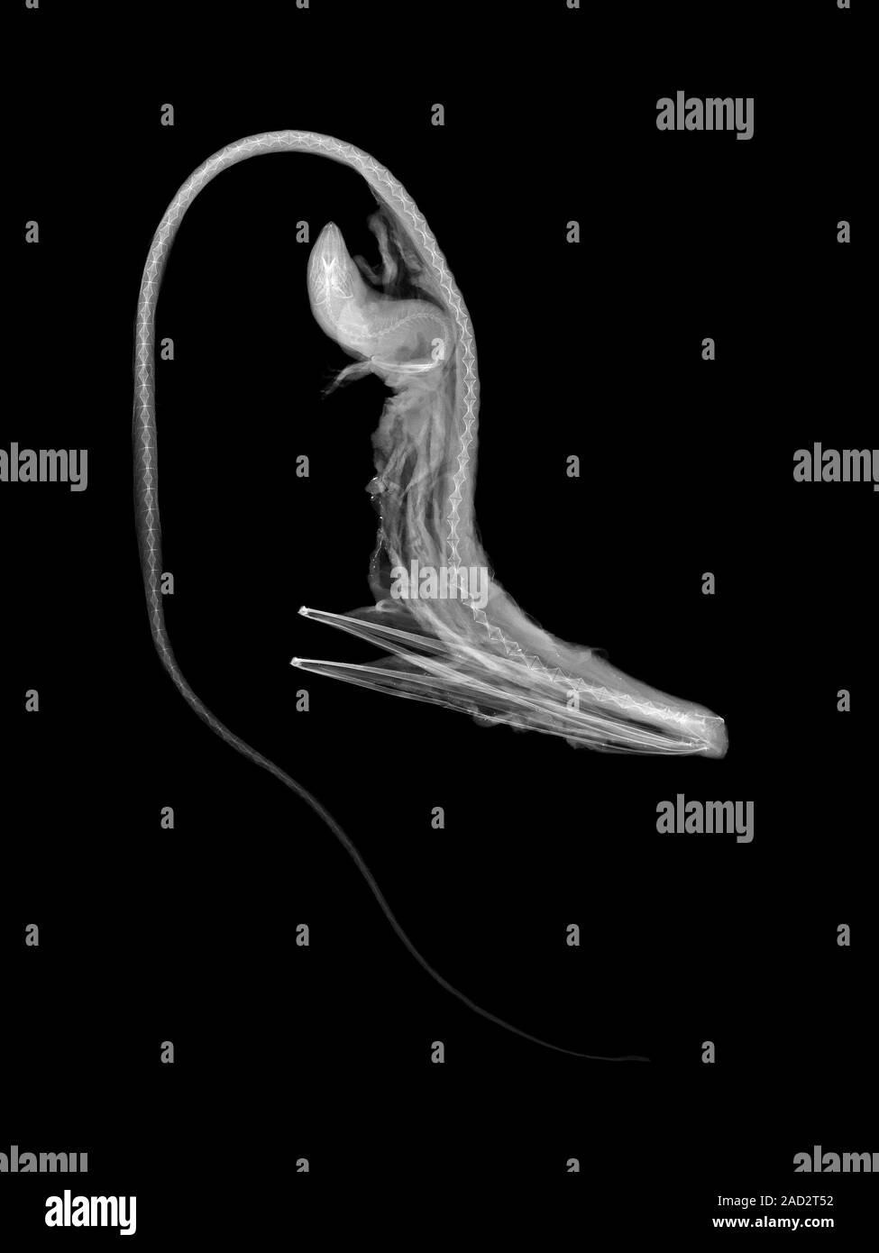 Pelican eel (Eurypharynx pelecanoides). X-ray of a section through a ...