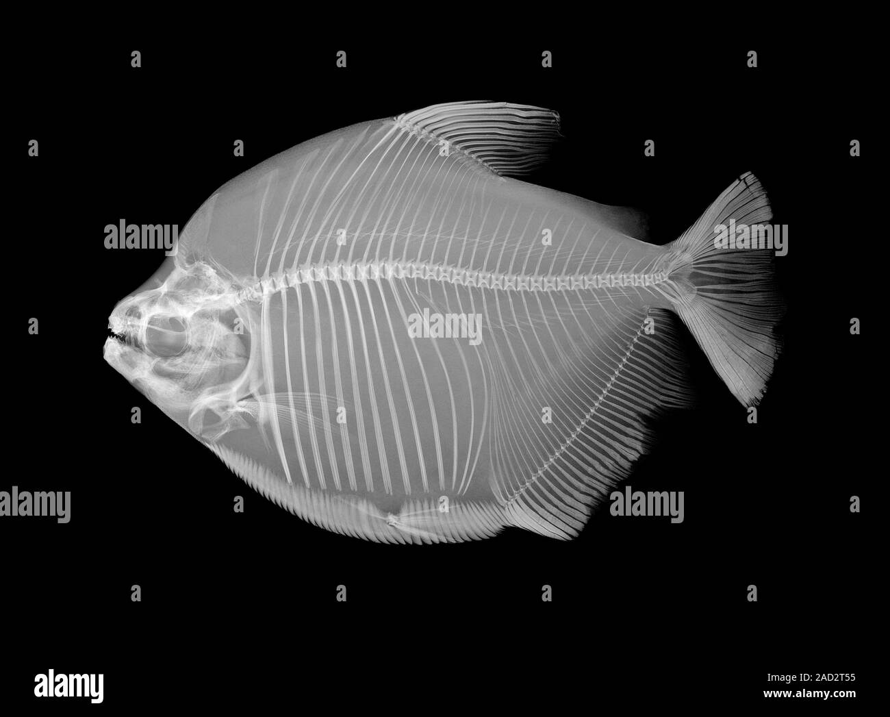 Pacu (Mylossoma duriventre). X-ray of a section through a Pacu, showing ...