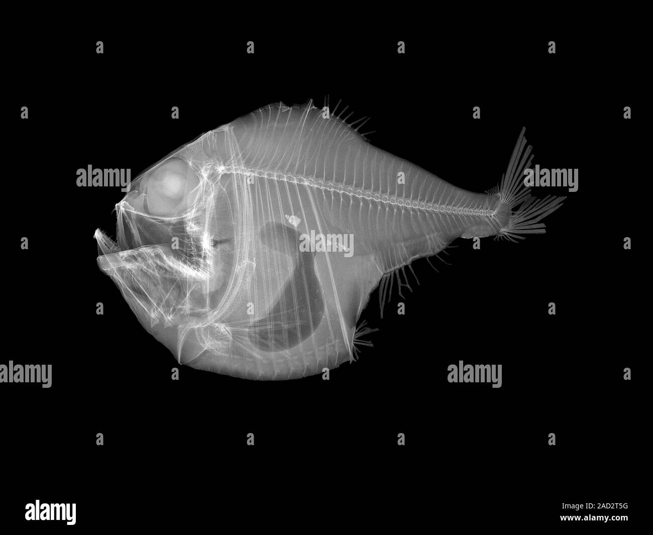 Marine hatchetfish (Argyropelecus lychnus). X-ray of a section through ...