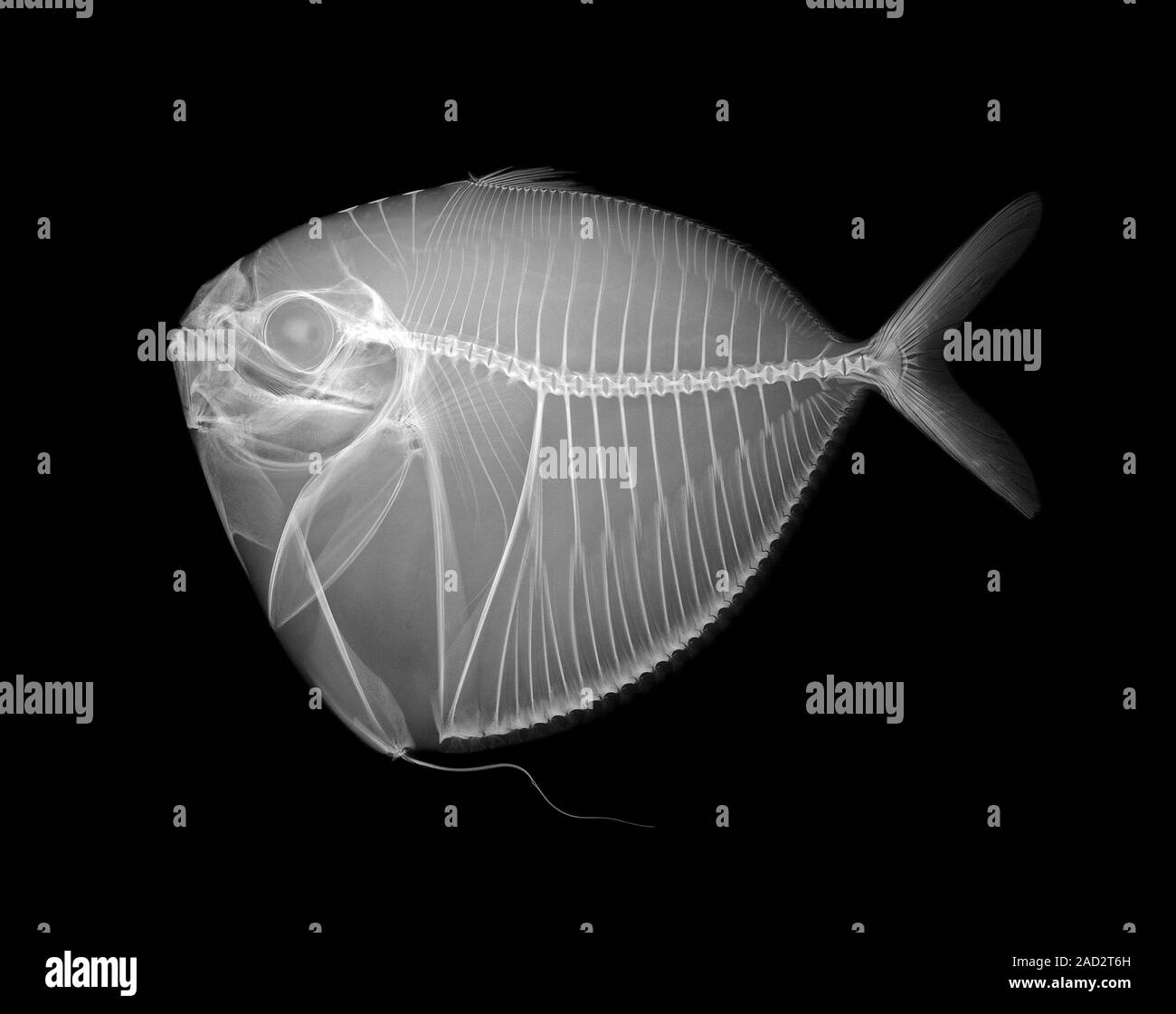 Moonfish (Mene maculata). X-ray of a section through a moonfish ...