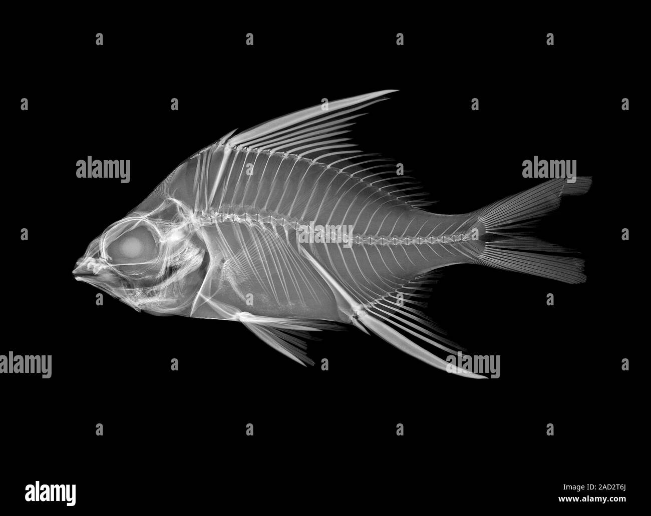 Striped mojarra (Eugerres plumieri). X-ray of a section through a ...