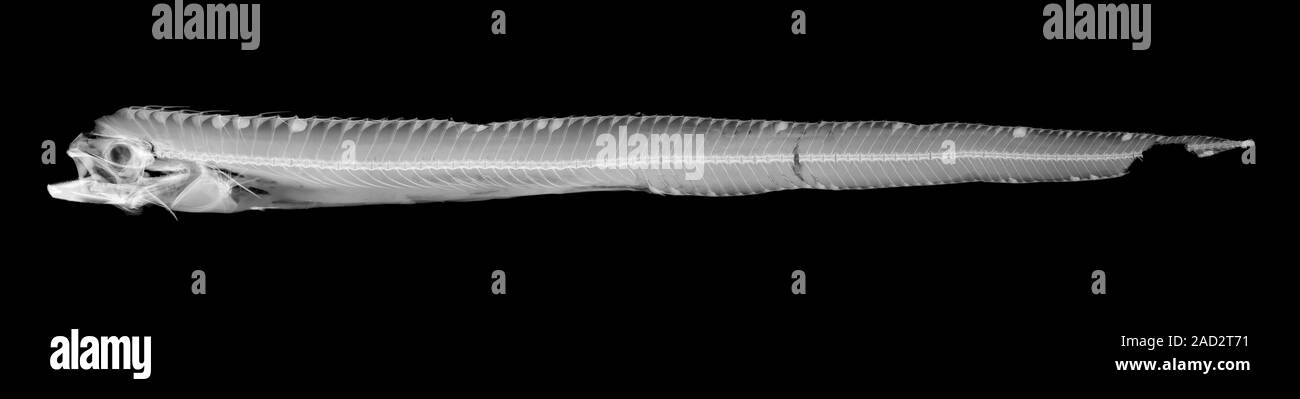 Channel scabbardfish (Evoxymetopon taeniatus). X-ray of a section ...