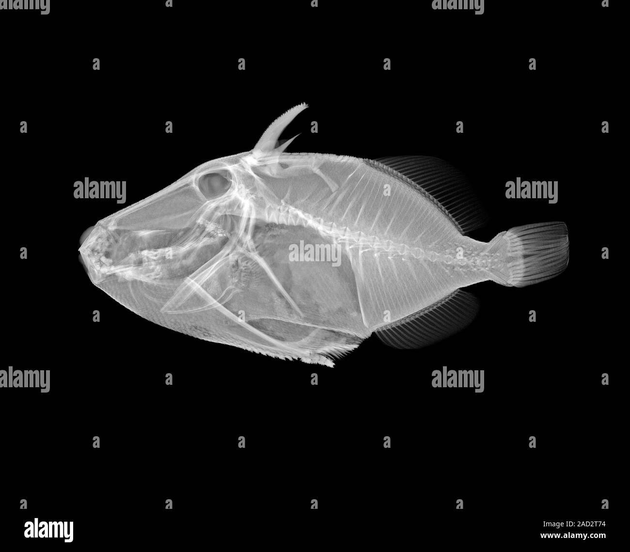 Wedge-tail triggerfish (Rhinecanthus rectangulus). X-ray of a section ...
