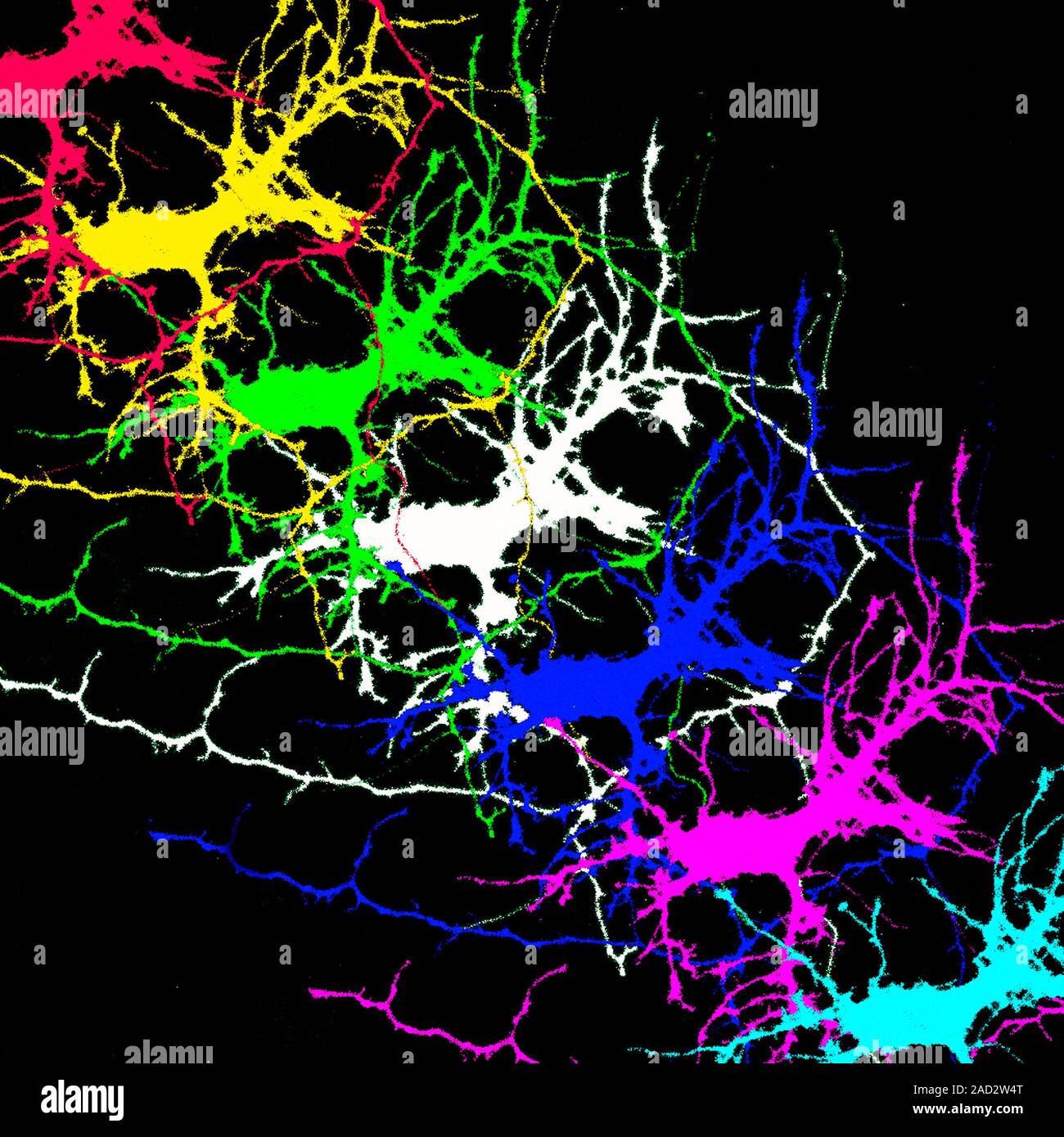 Brain activity. Montage of fluorescence light micrograph images showing ...