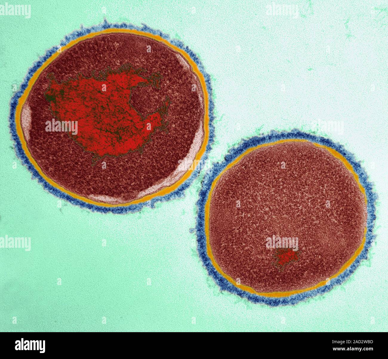 Streptococcus Pyogenes Bacteria Coloured Transmission Electron Micrograph Tem Of A Section