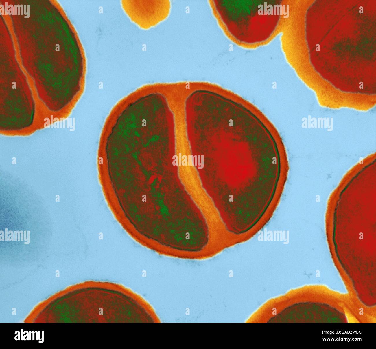 Staphylococcus epidermidis bacteria. Coloured transmission electron ...