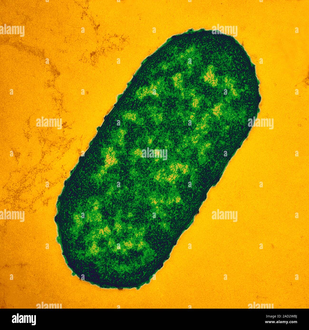 Klebsiella pneumoniae bacterium. Coloured transmission electron ...