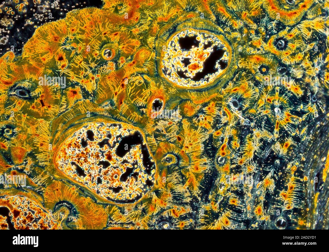 Silver-stained section of adult bone tissue viewed with darkfield light ...