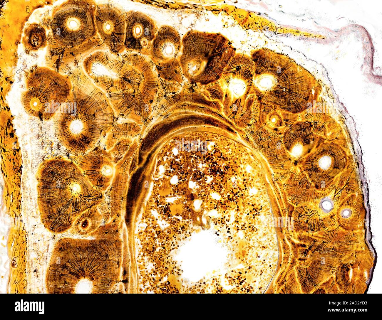 Silver-stained section of adult bone tissue viewed by light microscopy ...