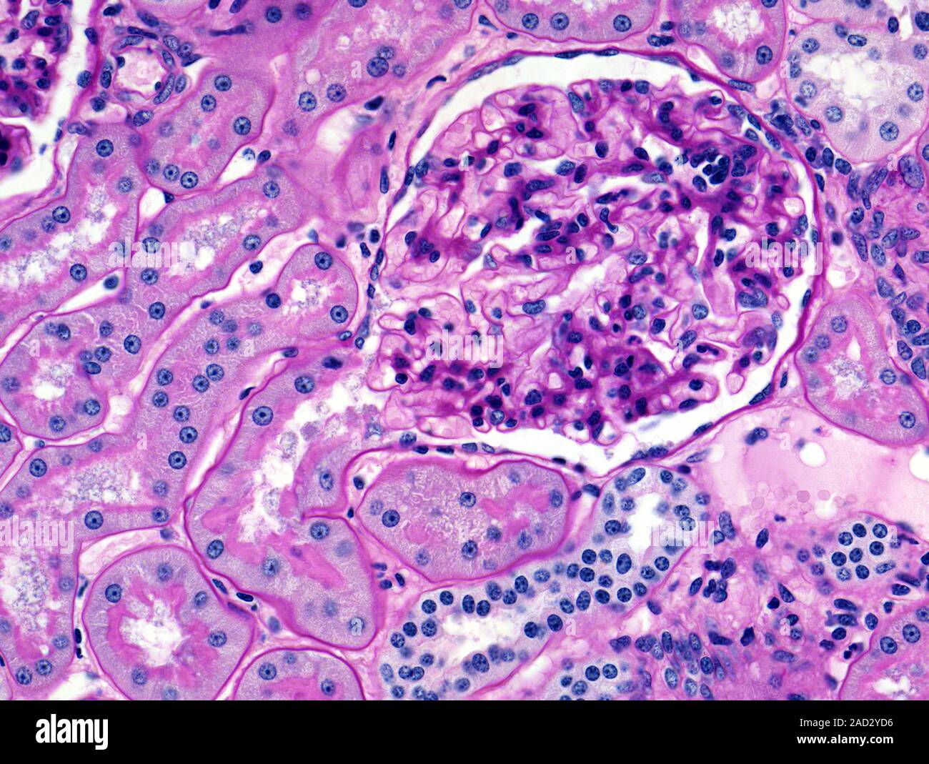 Light microscopy of a glomerulus in the kidney. Glomeruli also known as ...