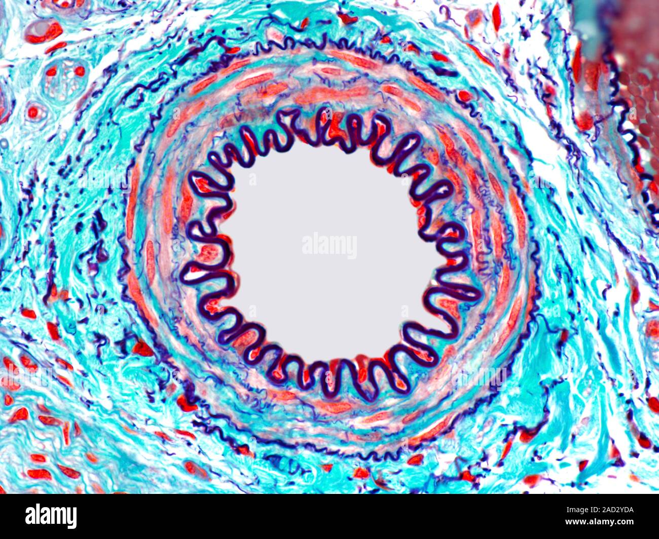 Light microscopy of a small muscular artery a common type among ...