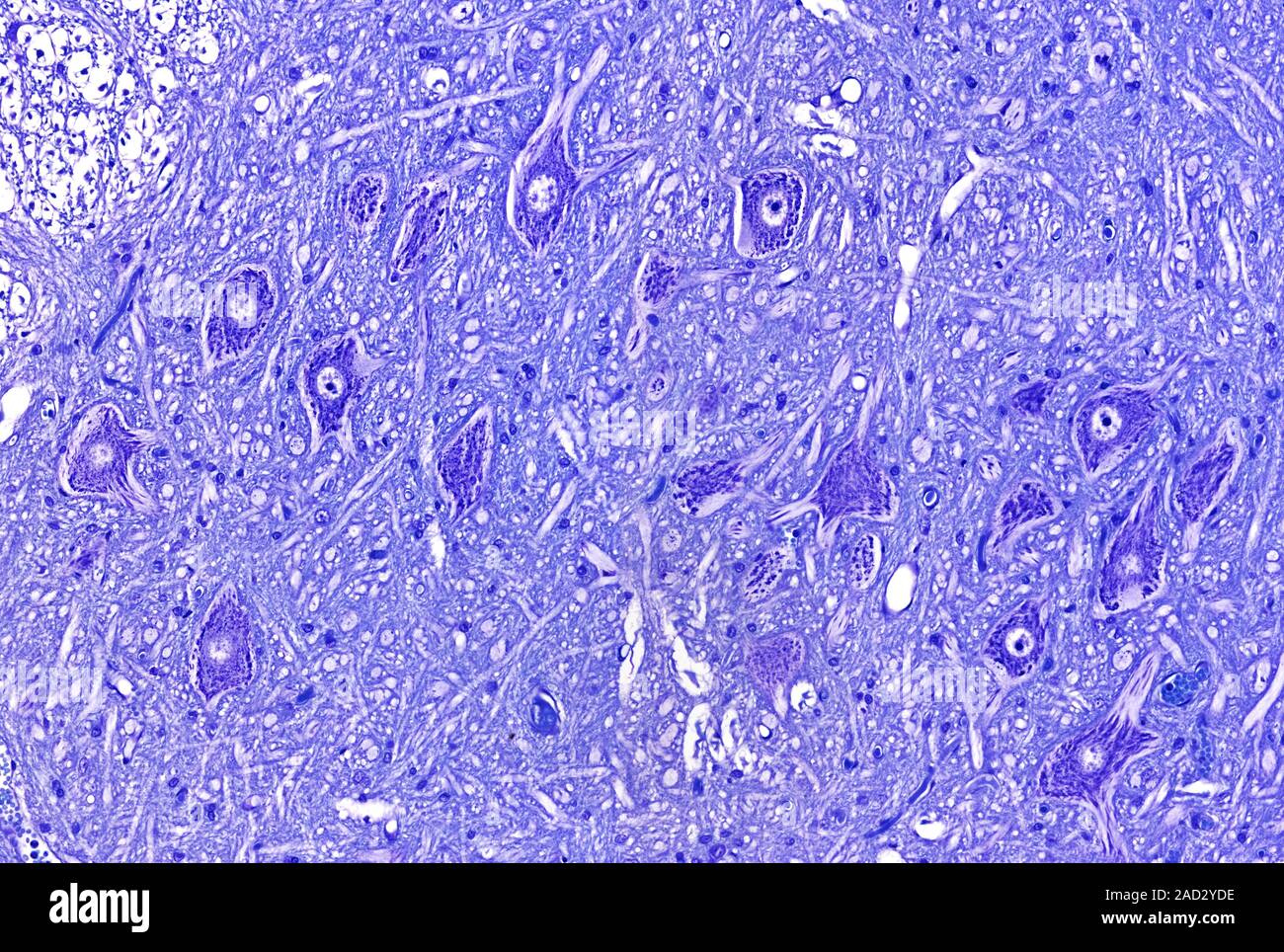 Light micrograph of motor neurons of the spinal cord grey matter. These ...