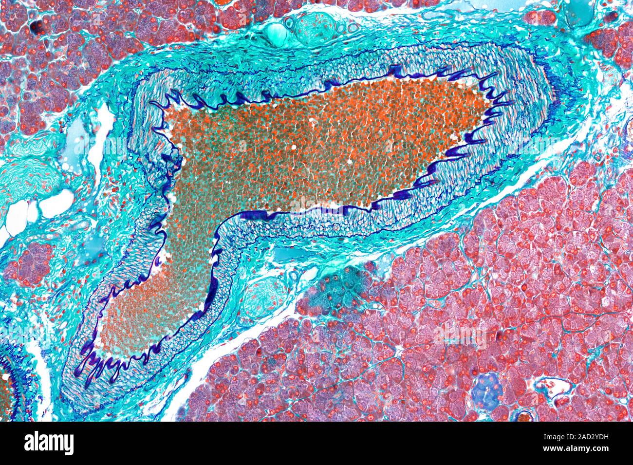 Light microscopy of a muscular artery a common type among arteries ...
