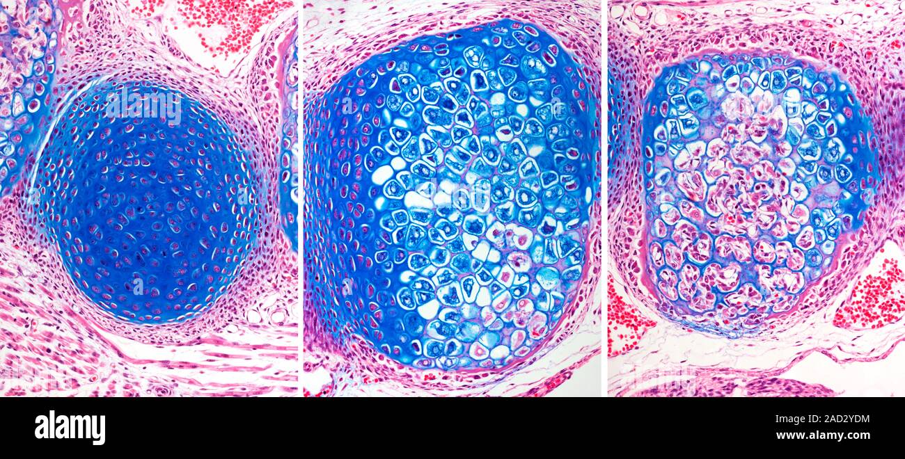 Hyaline cartilage (fetal ribs cross-sections) showing left ...
