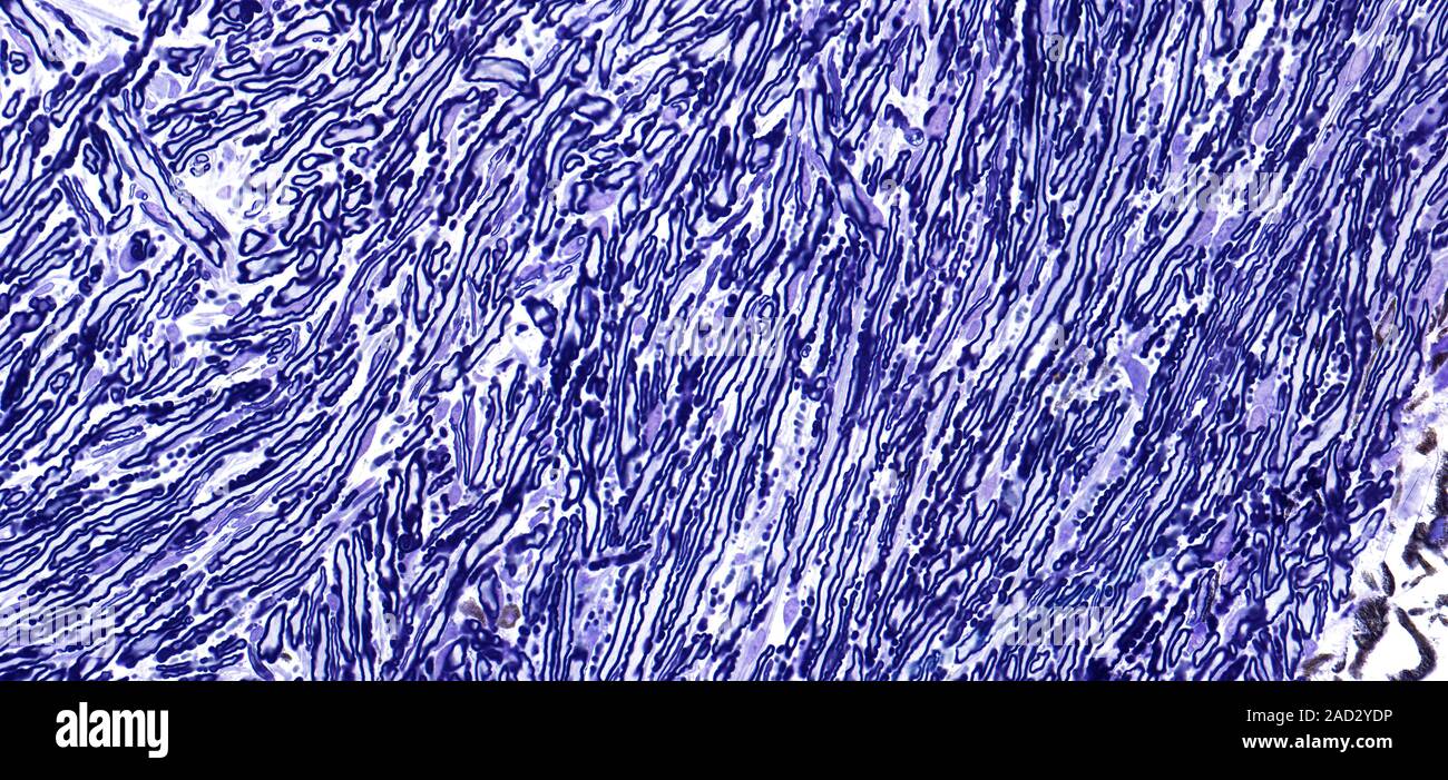 Light microscopy of myelinated nerves in a toluidine blue-stained ...