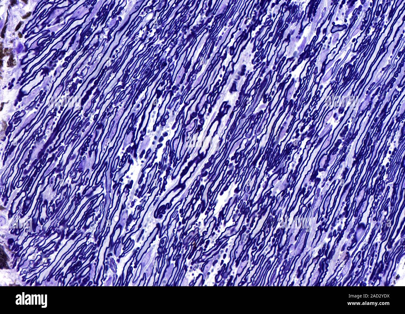 Light microscopy of myelinated nerves in a toluidine blue-stained ...
