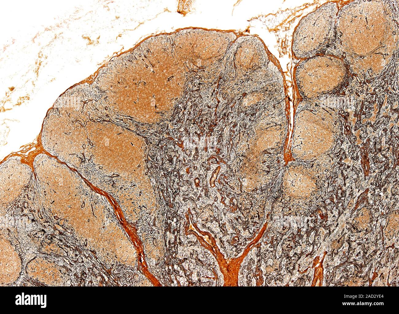 Light microscopy of part of a lymph node stained to show the connective ...