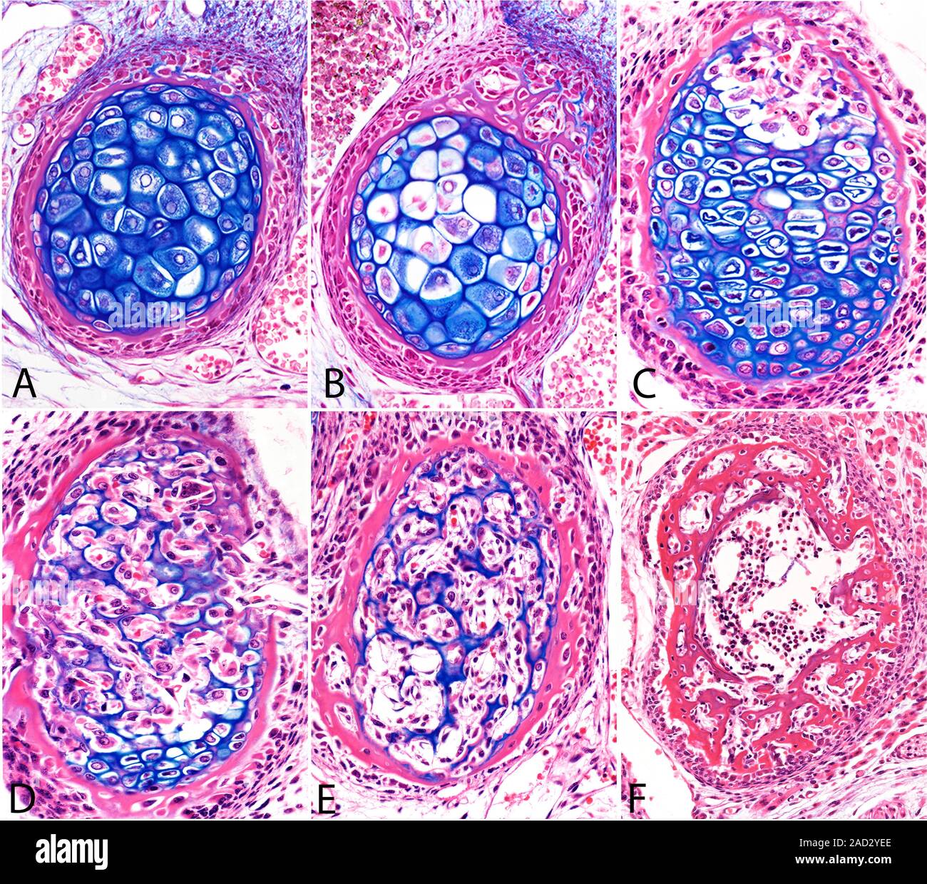 Timeline series of histologic sections of bone growth showing ...