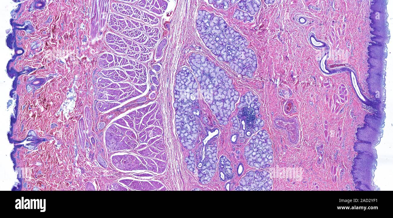 Full thickness section through the human lip viewed with light ...