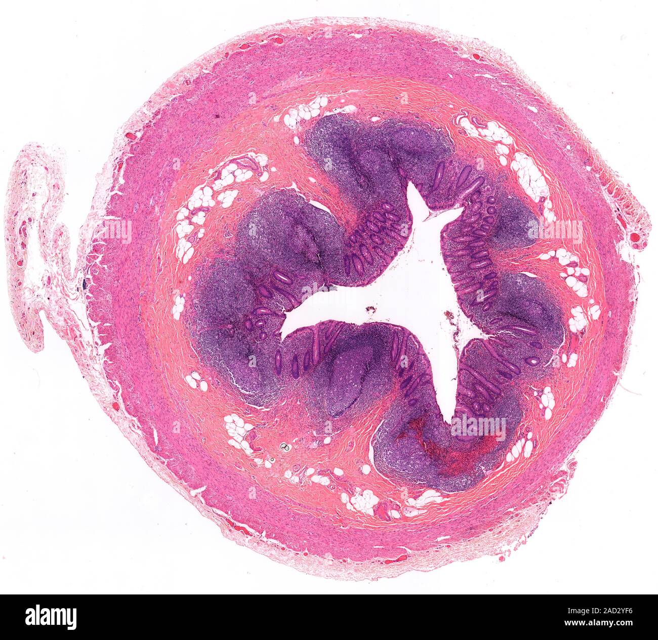 Human appendix in cross-section viewed by light microscopy. The mucosa ...