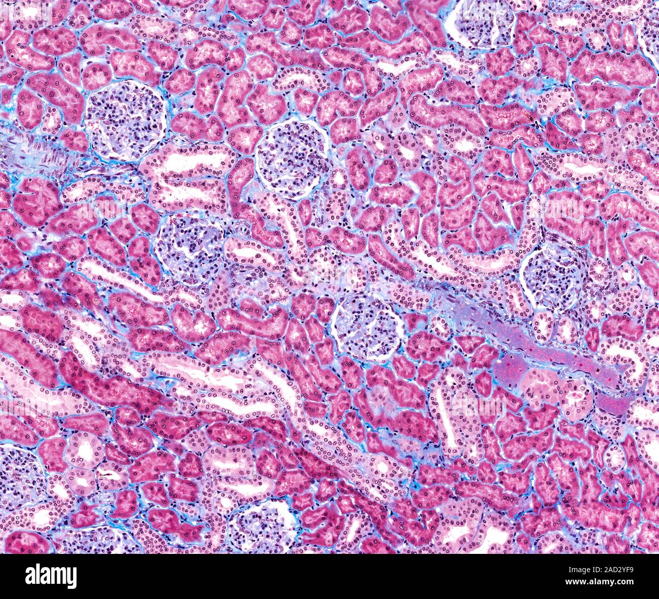 Light micrograph of a section of the kidney cortex. Round renal ...