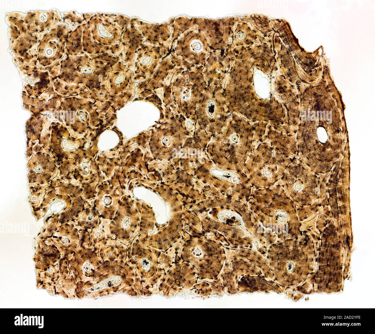 Light micrograph of an unstained, thick ground section of adult bone ...