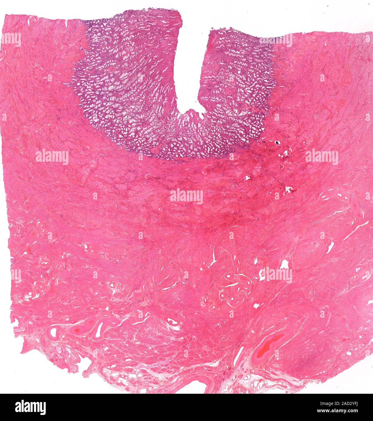 Light micrograph of a sectioned human uterus in late secretory phase of ...