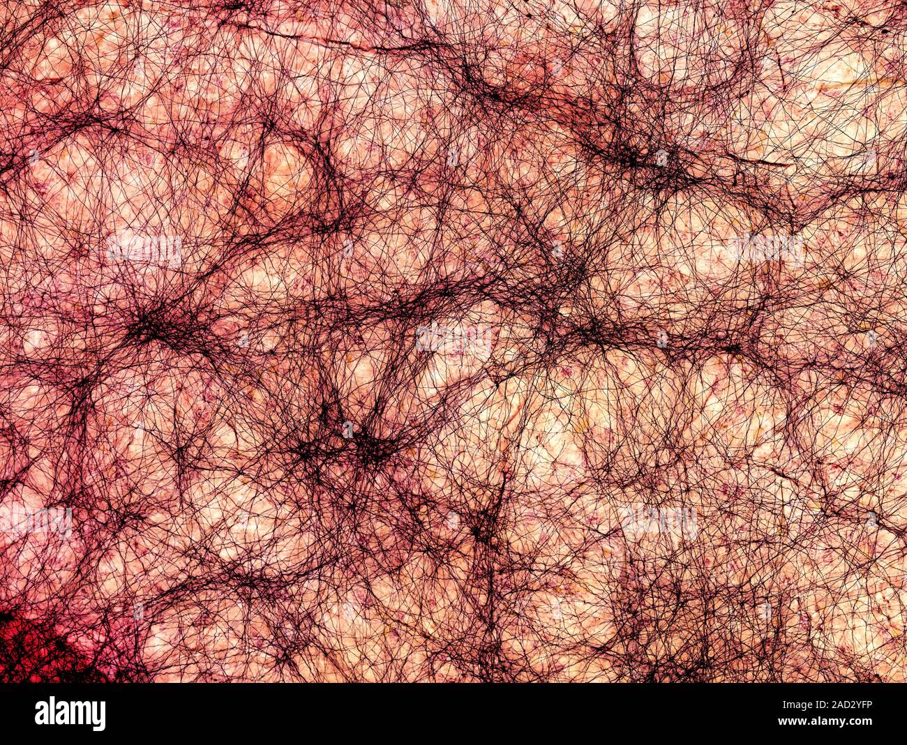 Light microscopy of a whole mount (thin sheet) of mesentery. A ...