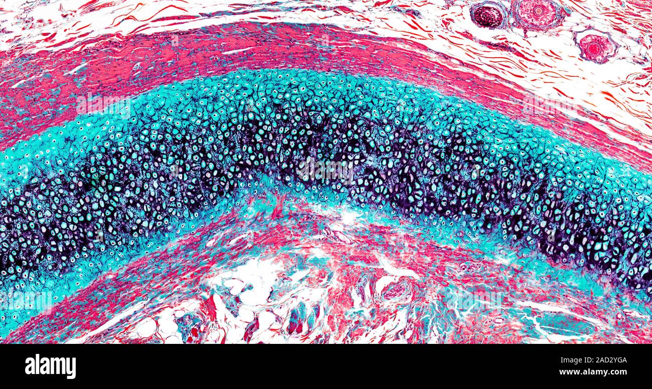 Section through the ear showing the inner core of elastic cartilage ...