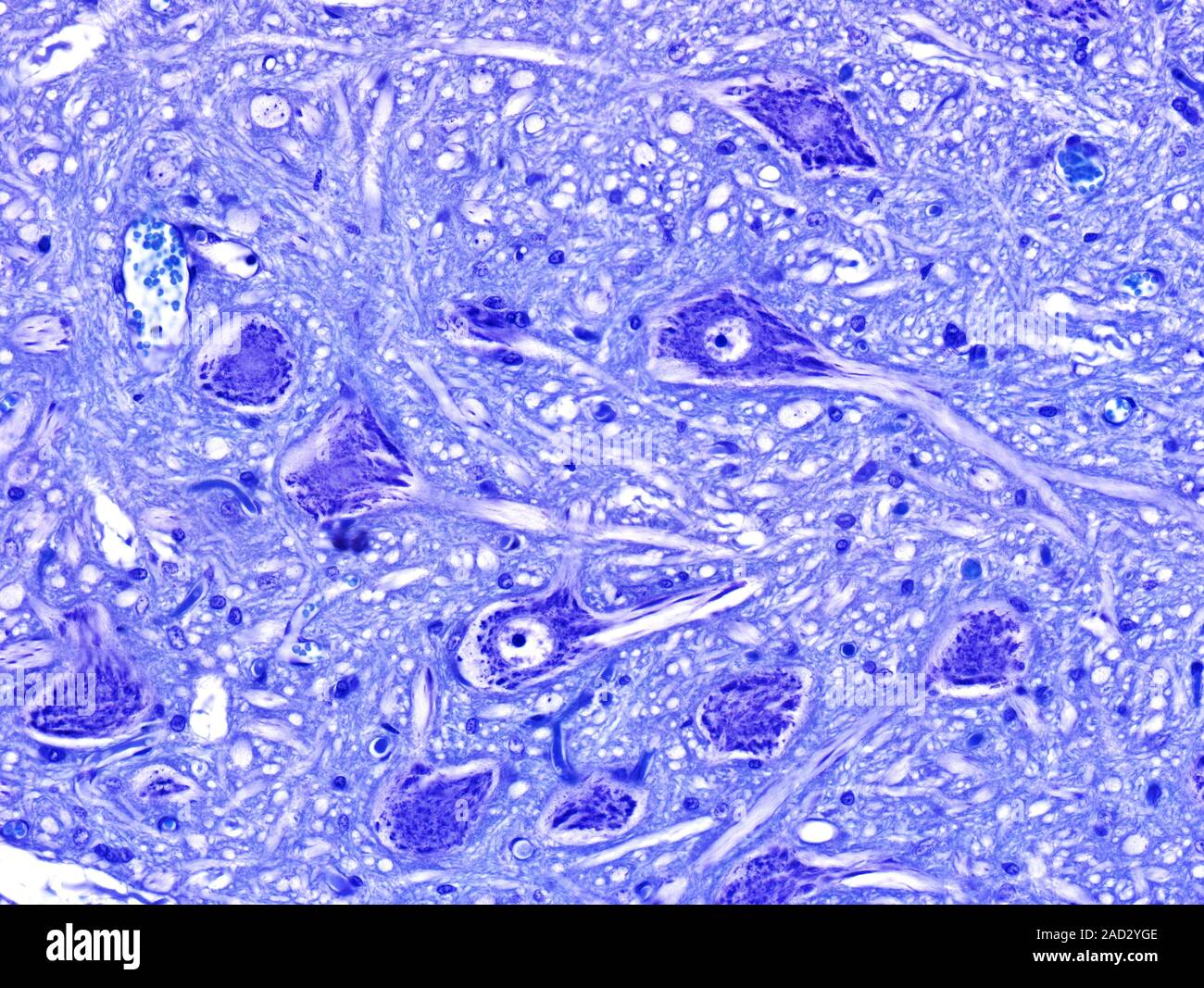 Light micrograph of motor neurons of the spinal cord grey matter. These ...