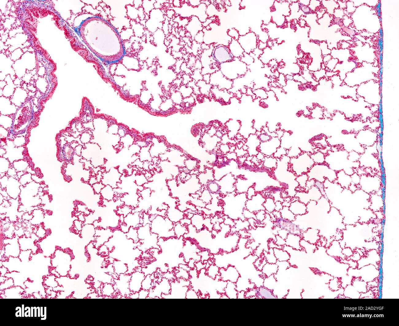 Termination of the respiratory tree or passages within the lung. A ...