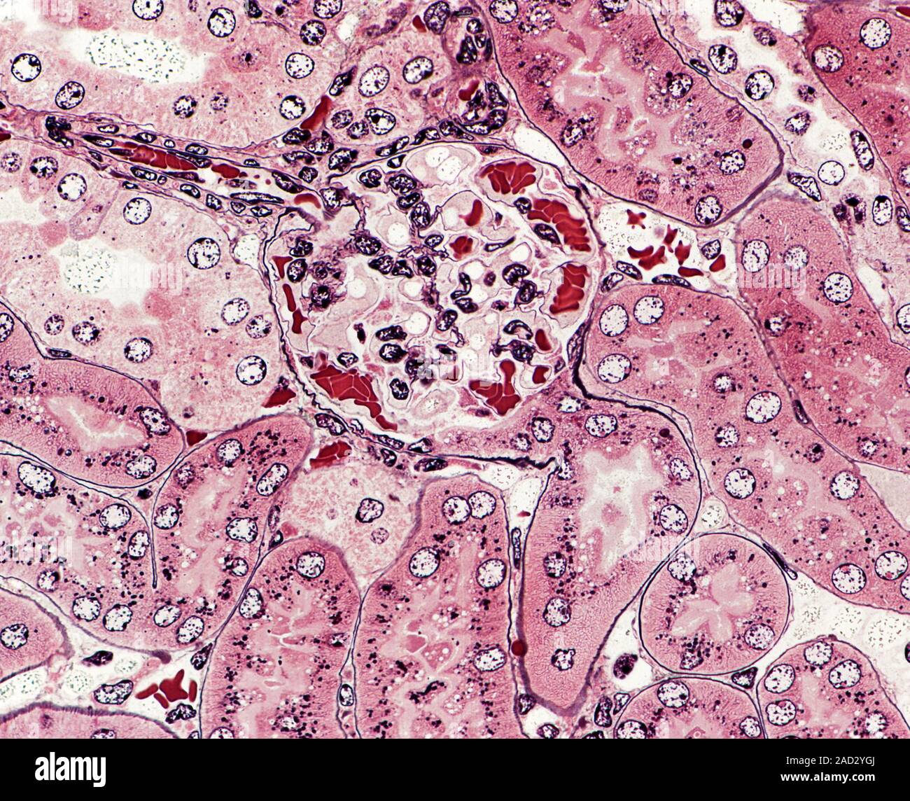 Light microscopy of a glomerulus in the kidney. Glomeruli also known as ...